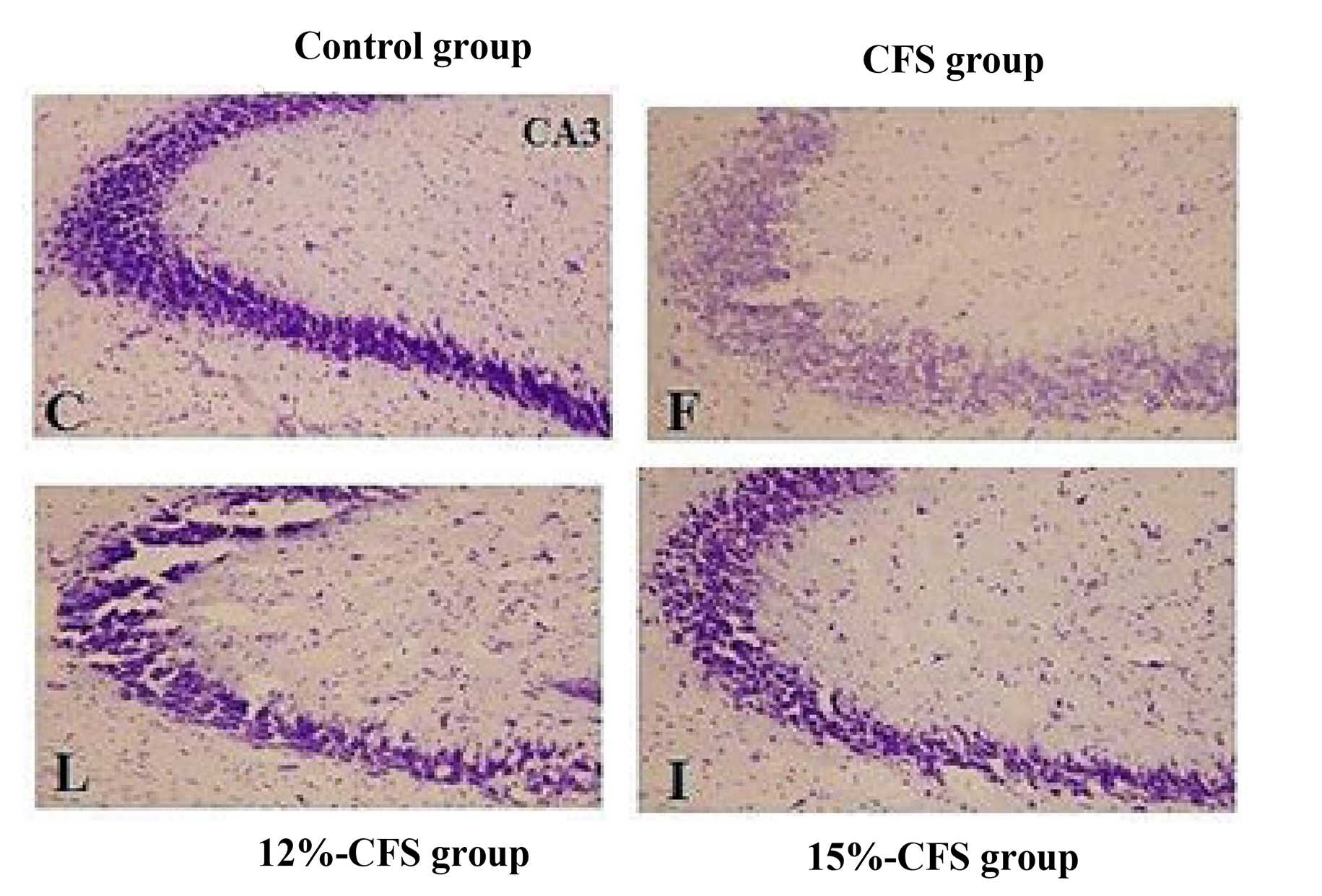 Effects of Intermittent Hypoxia Exposure on Symptoms of Chronic Fatigue ...