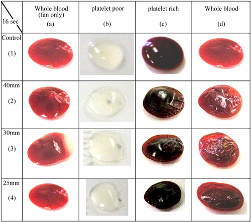Hemostasis Efficacy and Mechanism of Cold Atmospheric Air Plasma
