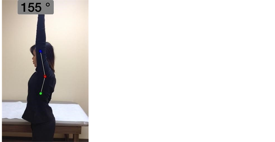 What Is the Accuracy of Shoulder Range of Motion Measurements on ...