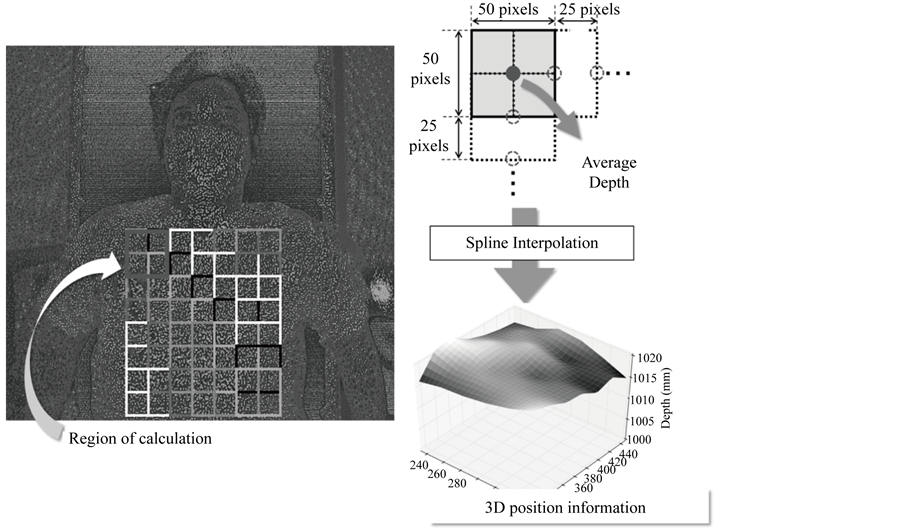 Markerless Respiratory Motion Tracking Using Single Depth Camera