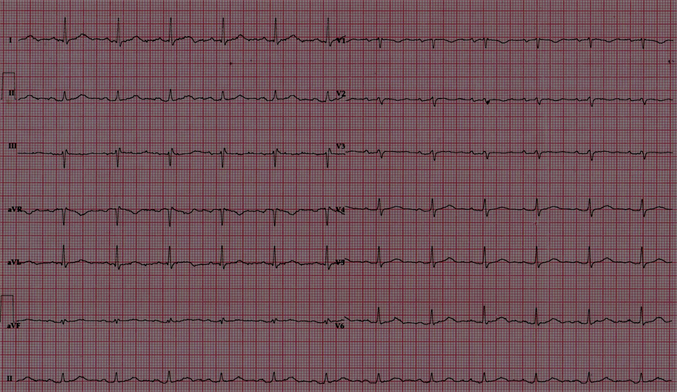 The Anti-Inflammatory Effects of NaCl with KCl as a Potent Graphene ...