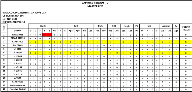 Development of Non-ABO Red Blood Cell Alloantibodies in Patient ...