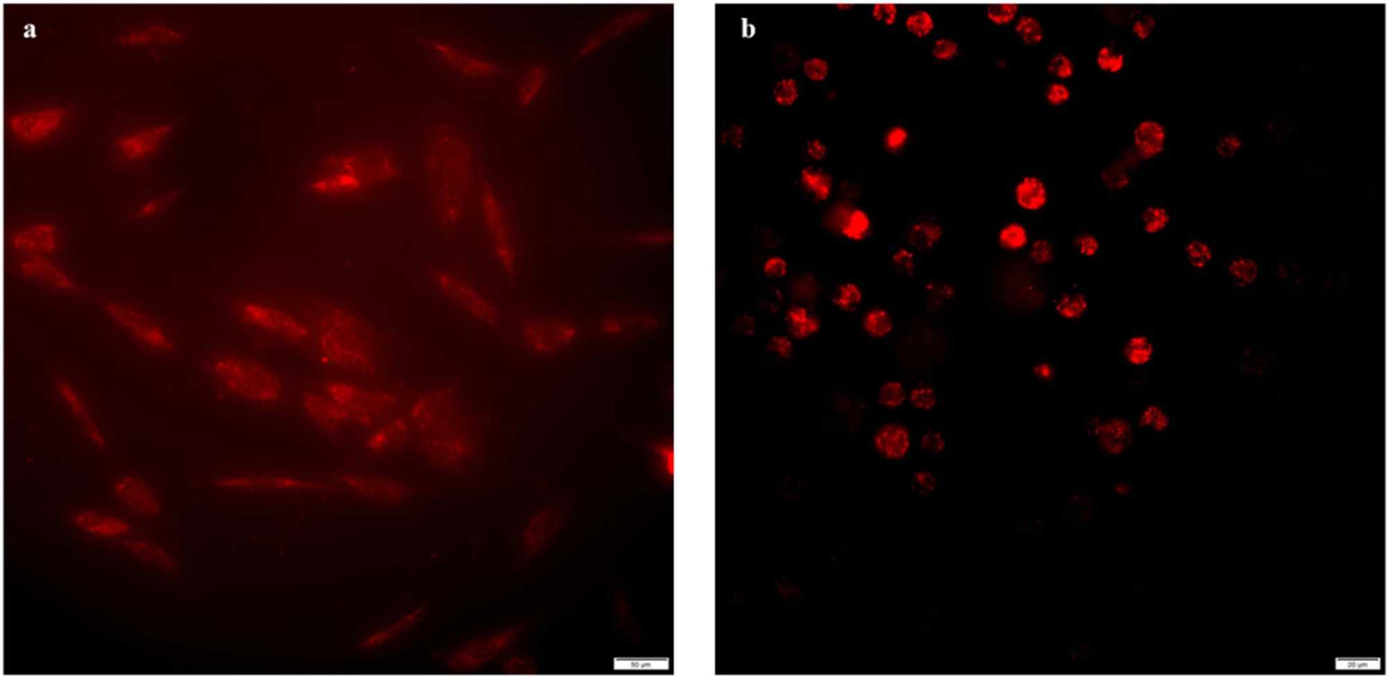 Cryopreserved Fibroblast and Mesenchymal Stem Cells (MSCs) Being Alternative Mitochondrial ...