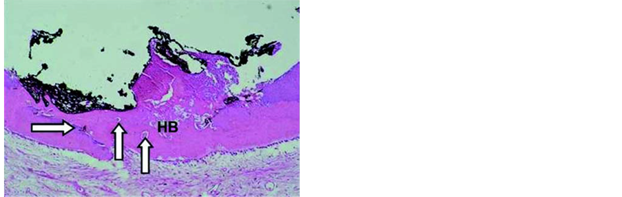 Calcium Hydroxide in Endodontics: An Overview