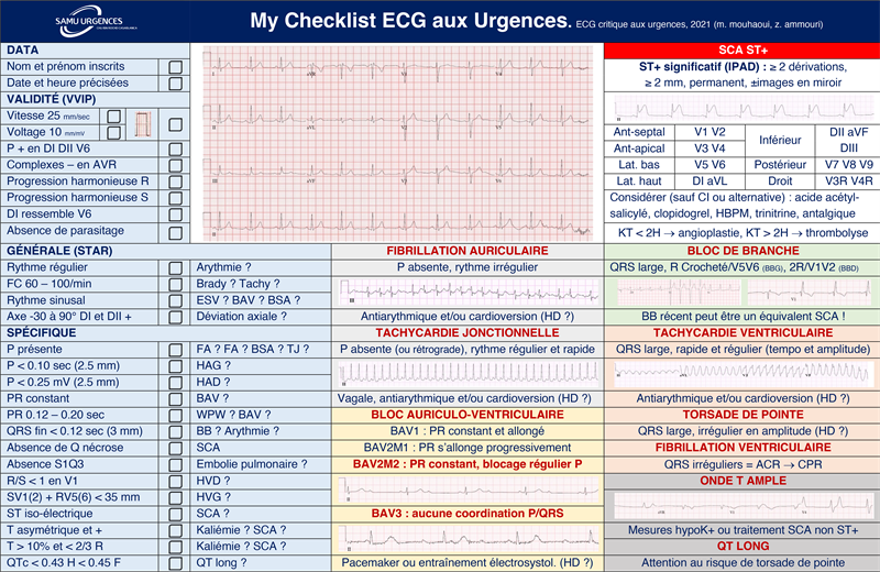Enhancing Emergency ECG Interpretation: A Practical Checklist Developed ...