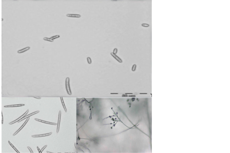 Genetic Diversity of Fusarium solani f. sp. cucurbitae, the Causal Root ...