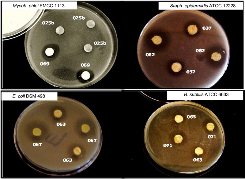 Isolation, Examination and Characterization of Actinomycetes as a ...