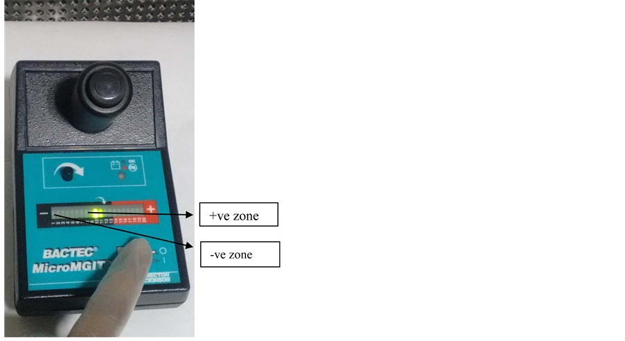Fast and Accurate Identification of M. tuberculosis Complex Using an ...