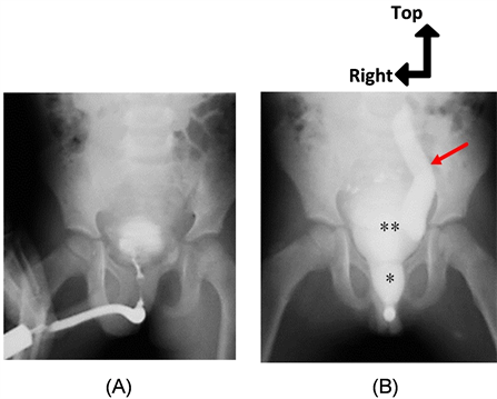Contribution of Medical Imaging in the Diagnosis of Urinary Disorders ...