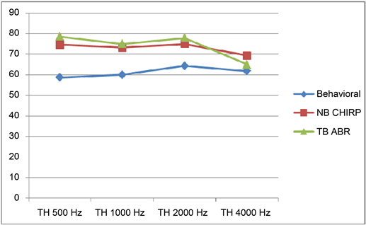 Hearing Threshold Evaluation in Children Using Narrow Band Chirp ...