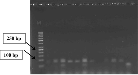 Selection of Tolerant of Some Citrus Hybrids F1 to Calcareous Stress and Identification Sexuall ...