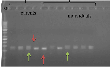 Selection of Tolerant of Some Citrus Hybrids F1 to Calcareous Stress and Identification Sexuall ...