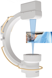 Radiation Protection of a Patient Undergoing an Orthopedic Procedure by ...