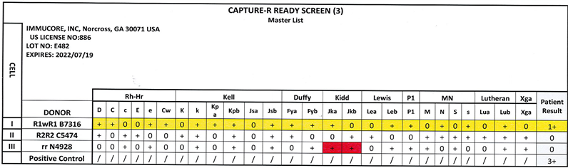Detection of Clinically Significant Warm Reactive Anti-A1 in a Post Red ...
