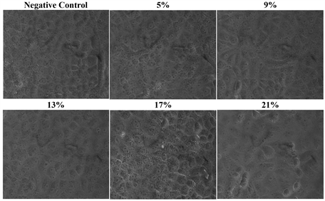 Black Garlic as an Antiviral for Herpes Simplex Virus-2 in Lung Cells