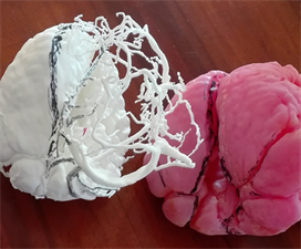 Role of Fresh Cadaver Practice and Jesus Prayers on Daily Base in ...