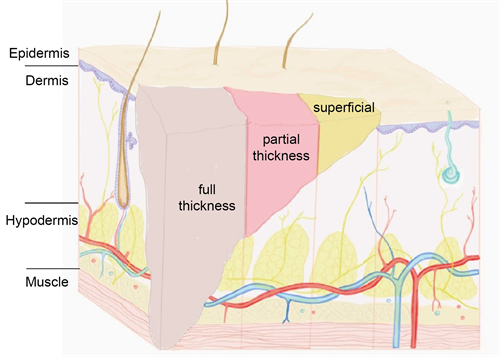 Regenerative Medicine: A Review of Solutions in the Treatment of Skin ...