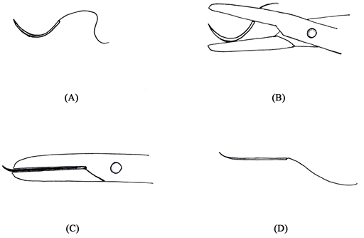 “Ski”-Shaped Microneedle Facilitates Suturing in a Deep Narrow Surgical ...