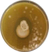 Evaluation of the Antimicrobial Activity of Endophytic Fungus Isolated ...