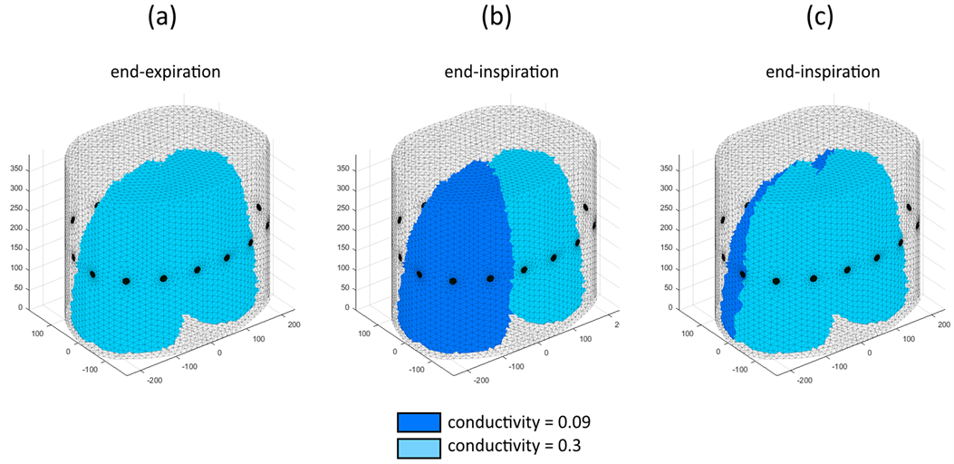 Comparison of Image Reconstruction Algorithms in EIT Imaging