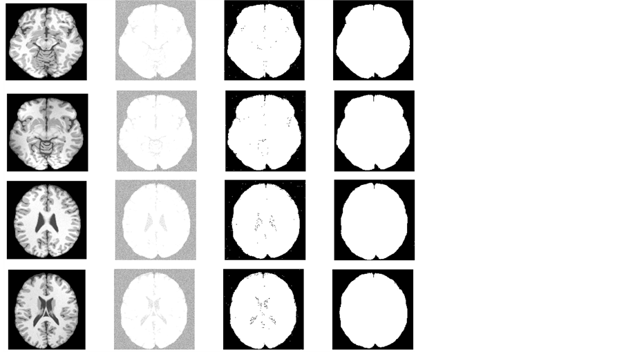 Medical Image Segmentation of Improved Genetic Algorithm Research Based ...
