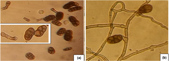 First Report of Stemphylium vesicarium Causing Onion Stemphylium Leaf ...
