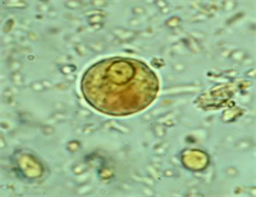Different Detection and Treatment Methods for Entamoeba histolytica and ...