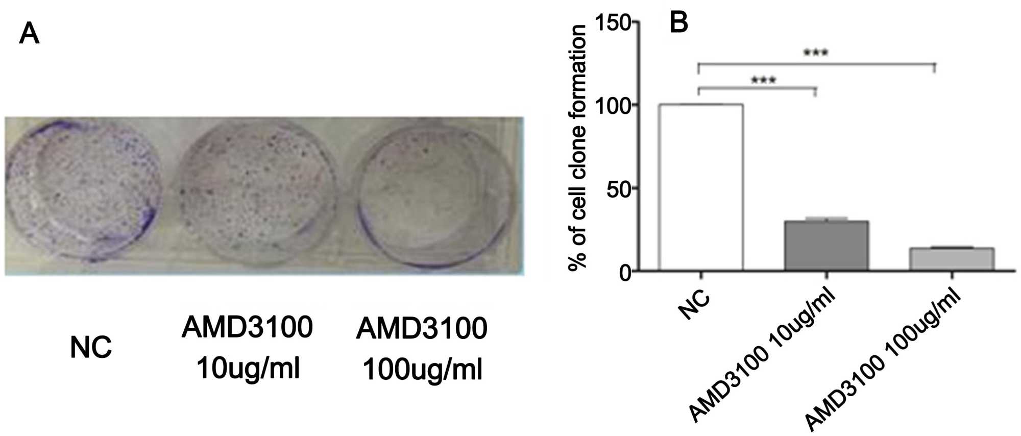 Targeted Blockage of CXCR4 on the Epithelial-Mesenchymal Transition ...