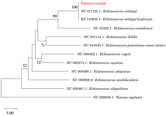Cytology and Genetic Analysis of Liver Echinococcosis in a Woman Came ...